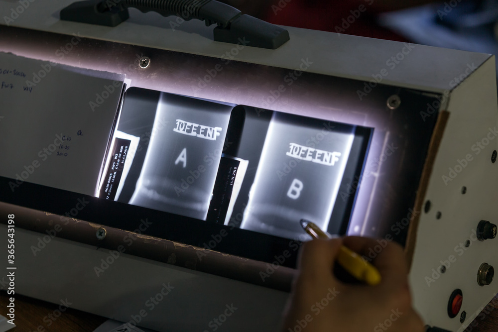 Foto de The radiography film operator level 2 evaluation radiographs of ...