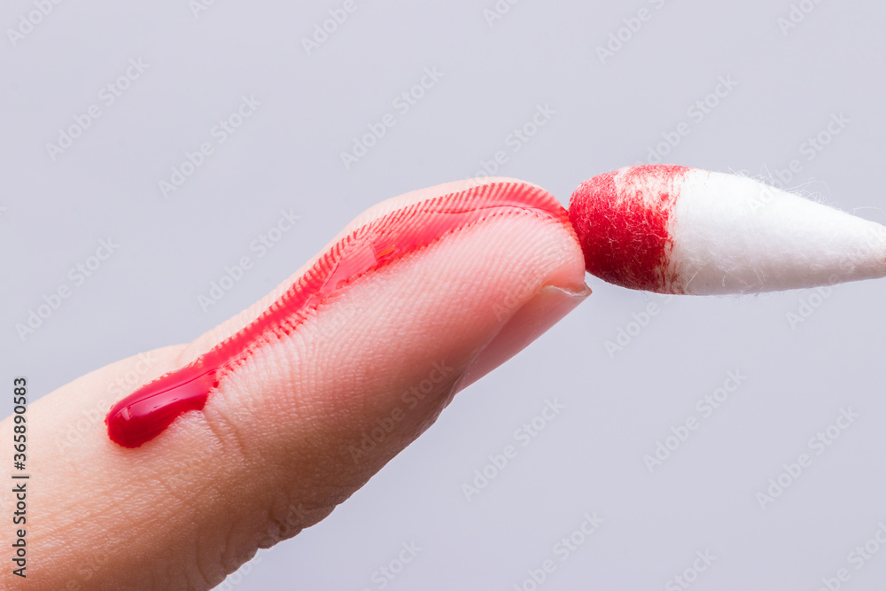 Use a cotton swab to wipe the blood at the wound on fingertips that are ...