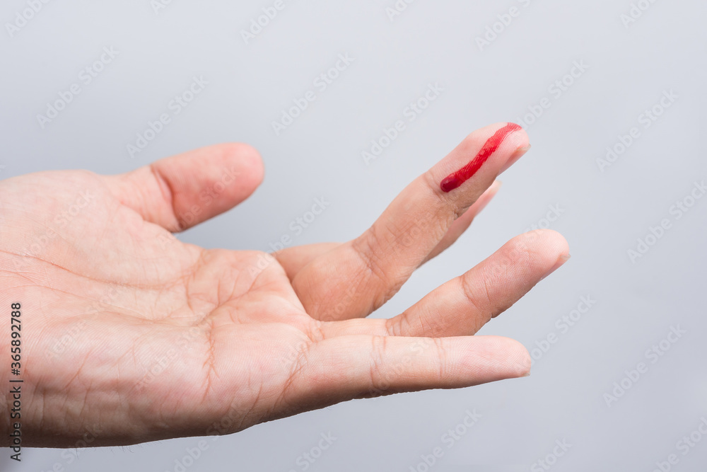 Bleeding blood from the cut finger wound. Injured finger with bleeding ...