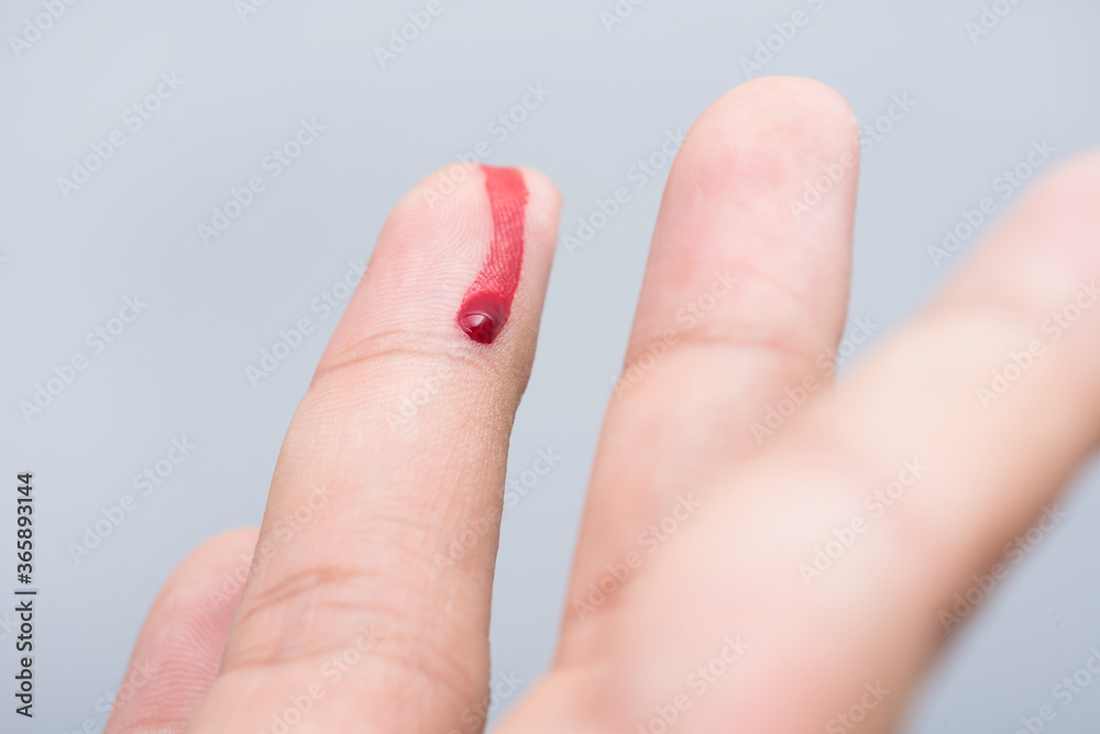 Bleeding blood from the cut finger wound. Injured finger with bleeding ...