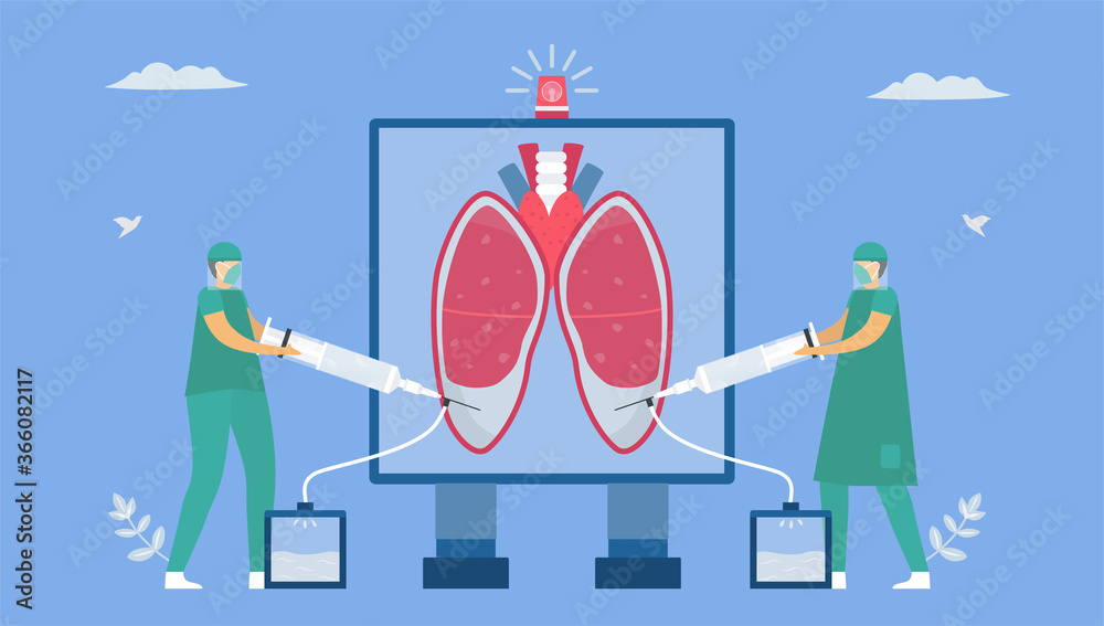 Pleural effusion is collection of excess fluid between layers of pleura ...