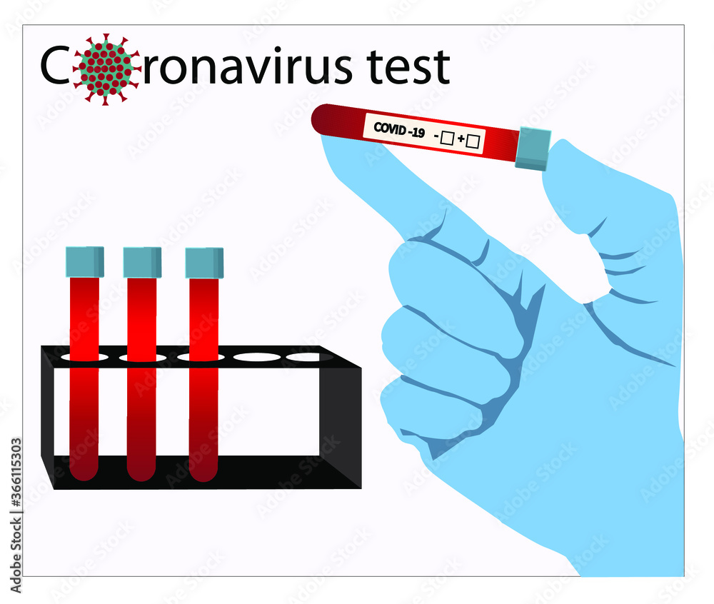 Coronavirus test. Vector. Test COVID-19 dangerous influenza virus in ...