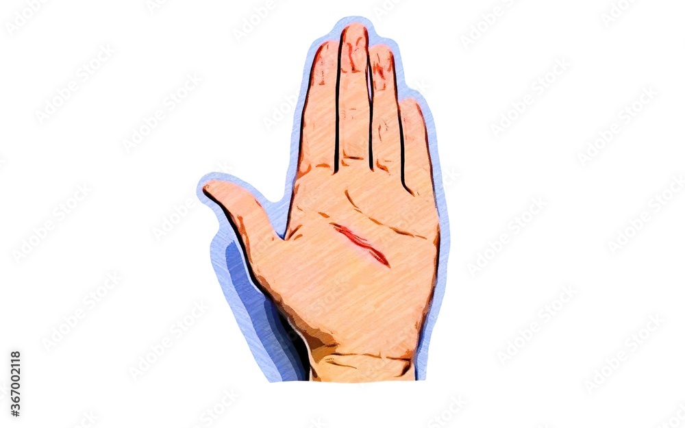 Hand with a wound illustration isolated on a white background Stock ...
