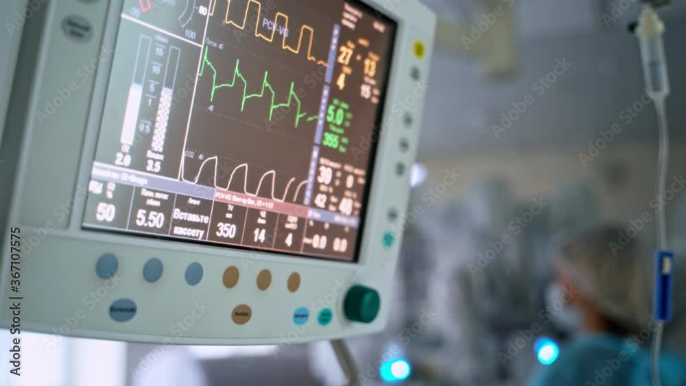 Monitor in the operating room. Diagrams of vital patient's signs on the ...