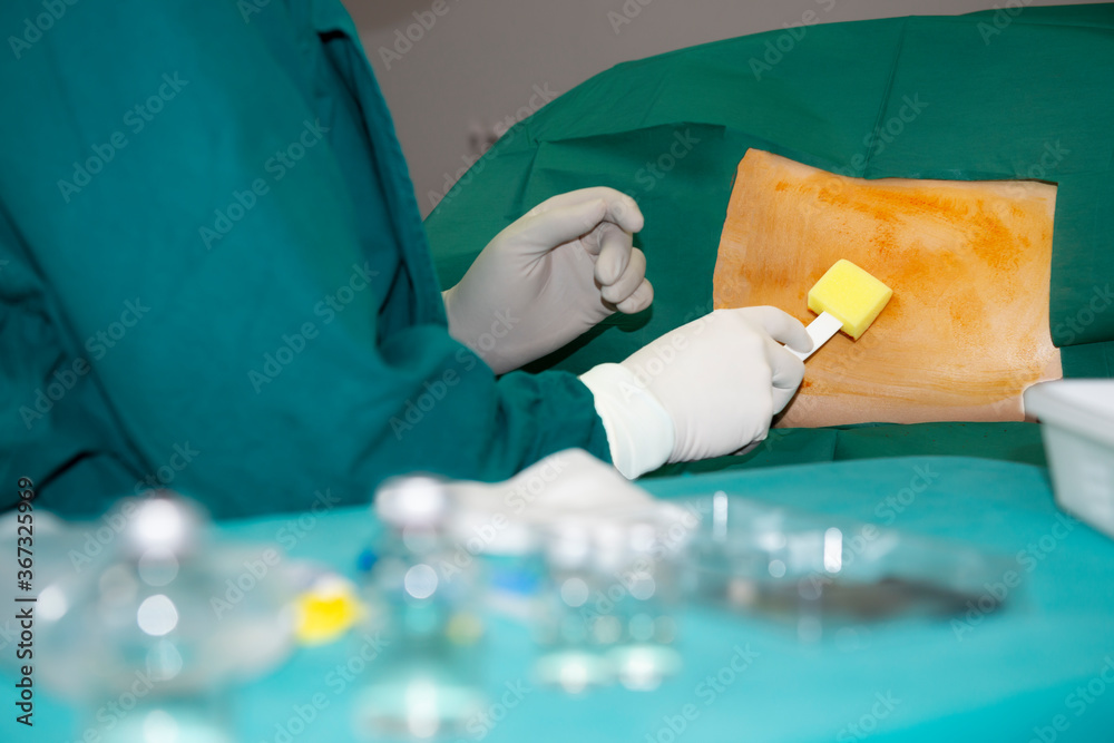 Cleaning with anti septic in the back prepare for epidural anesthesia ...