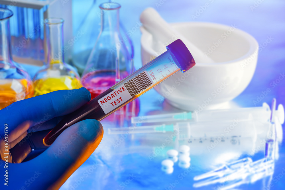 A rubber-gloved hand holds a test tube labeled Negative test. Negative ...