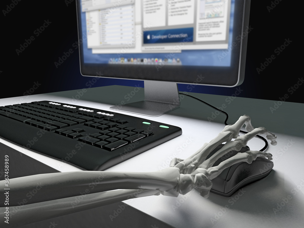 Carpal Tunnel Syndrome,Skeletons and computer, Arms bones on Office ...