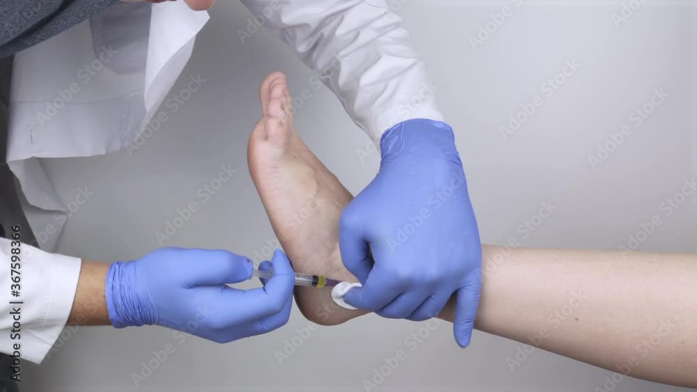 An orthopedic surgeon injects medicine into the Achilles tendon to ...