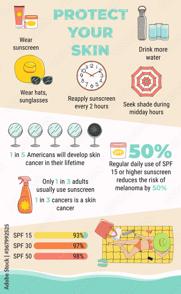 Infographic of protection against skin cancer from sunbathing Stock ...