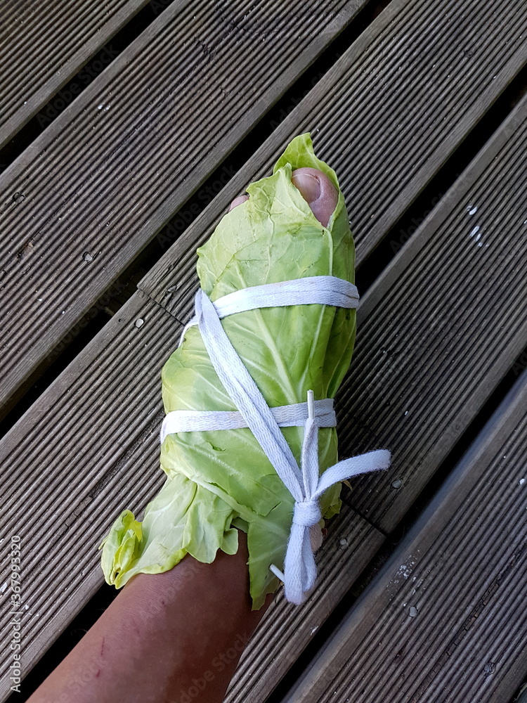 Wrapped legs with white cabbage leaves.Cabbage Leaves Can Pull Out ...