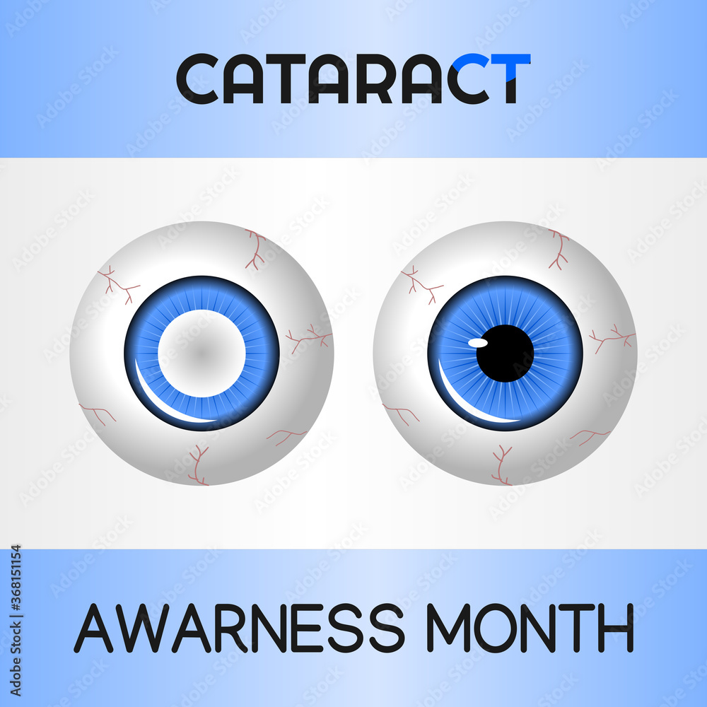 vector graphic of cataract awareness month good for cataract awareness ...