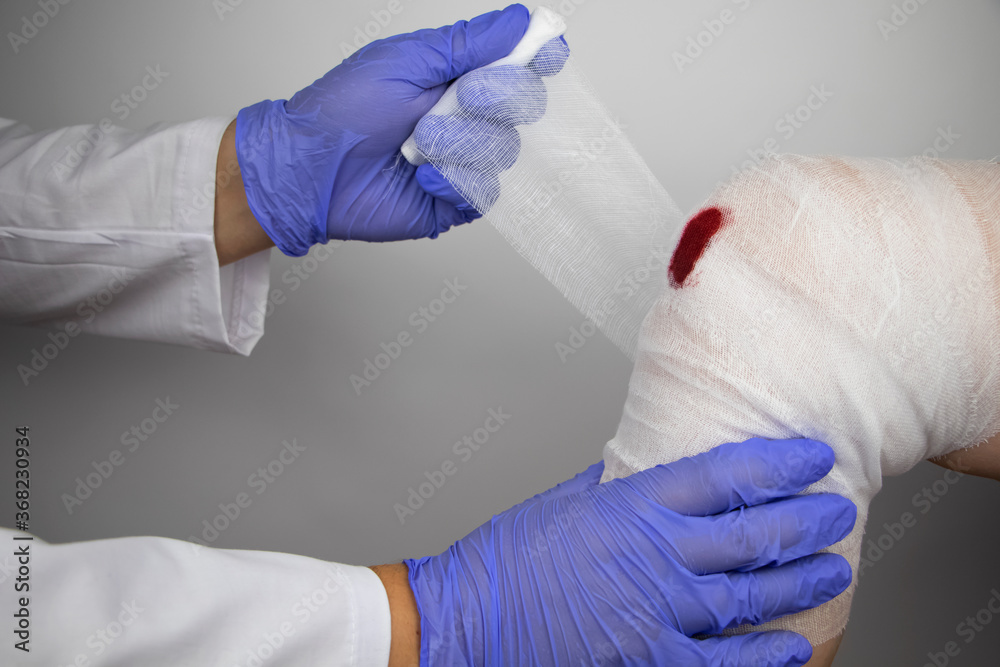 Hand Bandage Technique