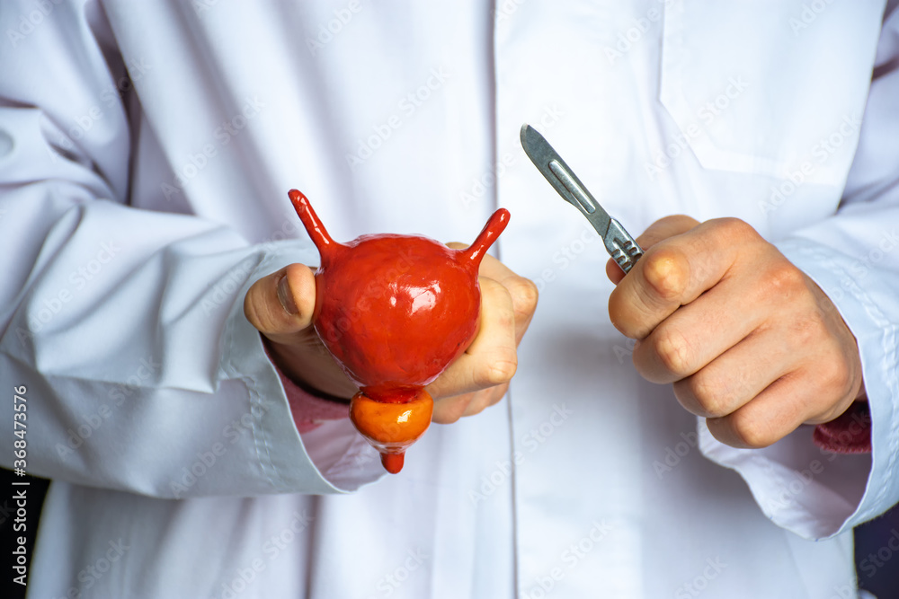Surgeon held scalpel over anatomical model of human bladder prostate ...