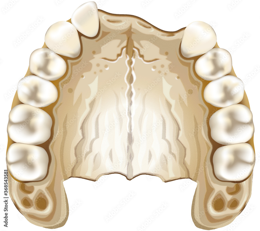 Maxillary bone atrophy with lost or damaged teeth Stock Illustration ...