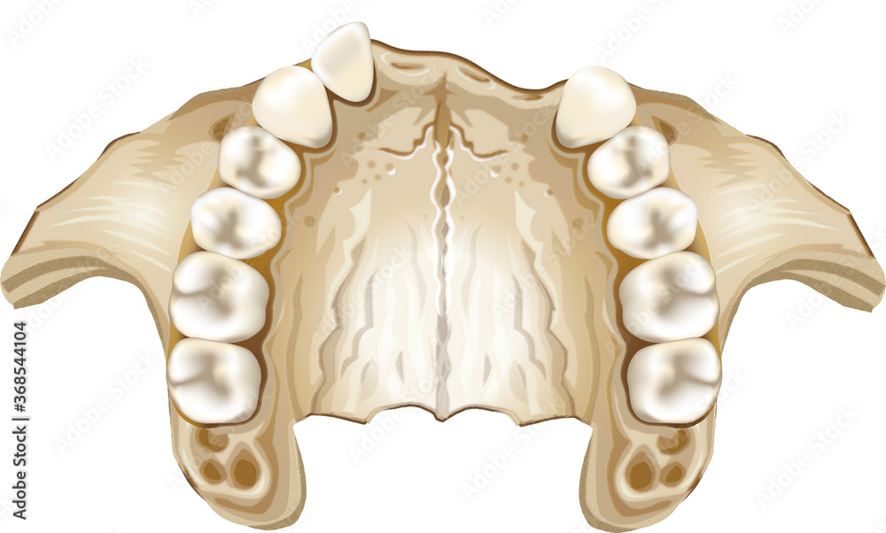 upper maxillary bone, atrophy, human bone, medically accurate ...