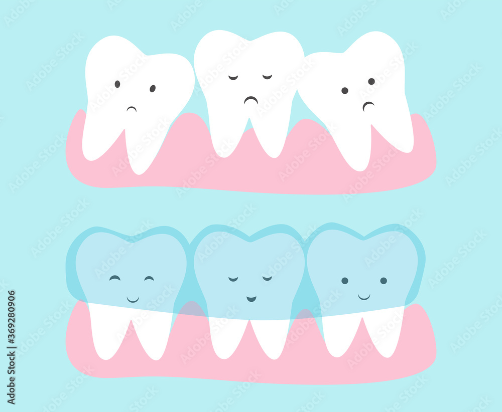 Cute tooth cartoon vector. Invisible dental aligner concept ...