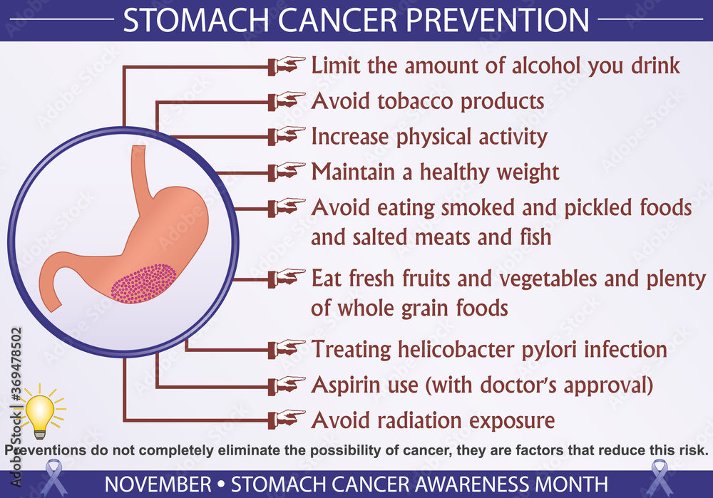 Stomach cancer prevention infographic vector. November stomach cancer ...