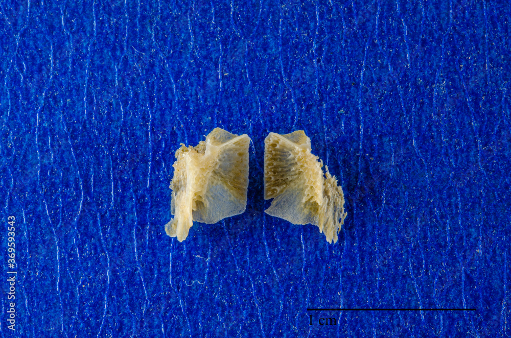 Lower surface of palatine bones, palate development, 10 weeks old human ...