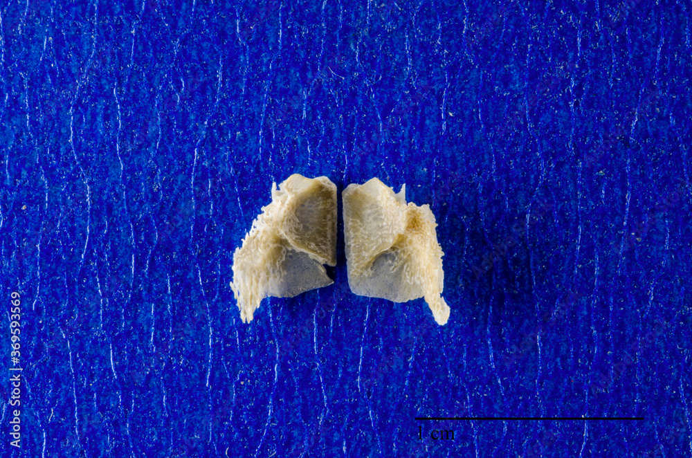 Upper surface of palatine bones, palate development, 10 weeks old human ...