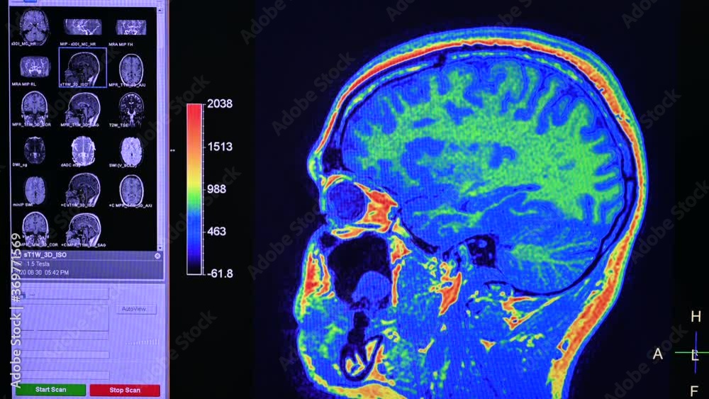 Video „Close up video of a MRI (Magnetic Resonance Imaging) or CAT ...