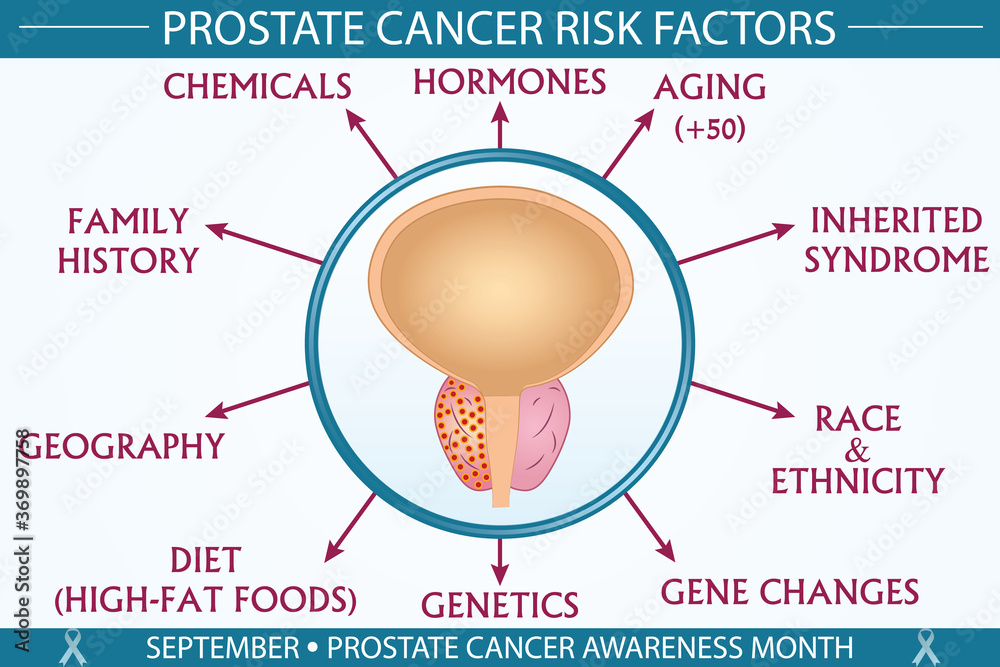 Prostate Cancer Awareness 2022