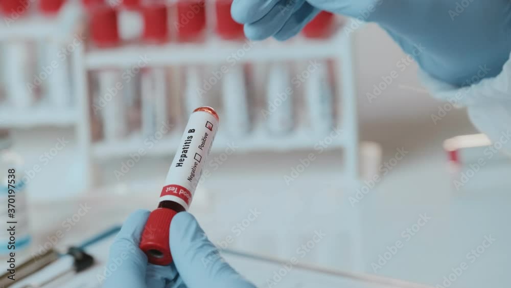 Doctor holds in one hand laboratory holds blood sample positive with ...