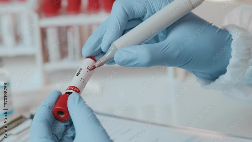 Doctor or laboratory technician holds in one hand laboratory positive ...