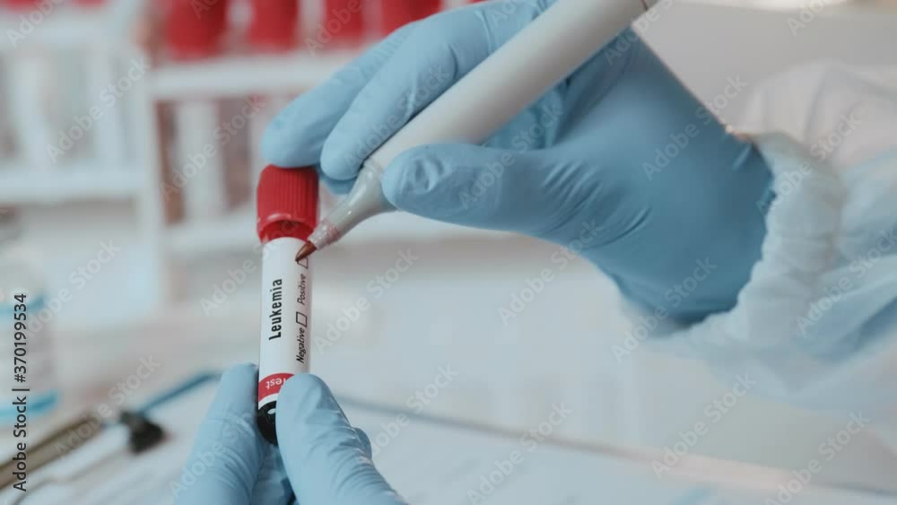 Doctor or laboratory technician holds in one hand laboratory blood ...