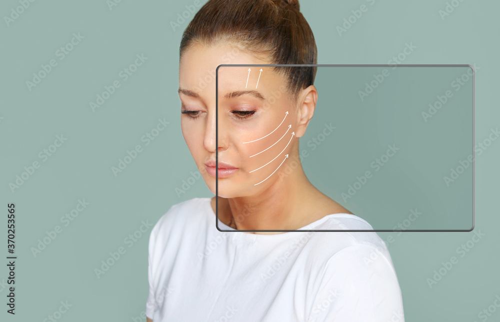 Effects of ageing,Frown/scowl lines ,Nasolabial folds,Neck ,Under eye ...