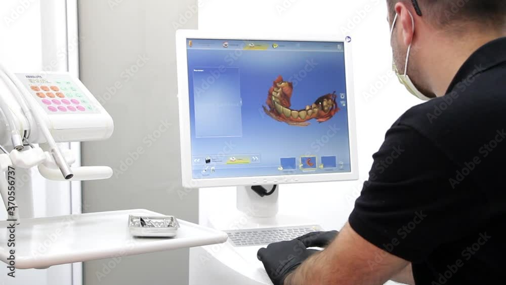 Dental scanning for treatment. 3D graphics of scanned teeth on the ...