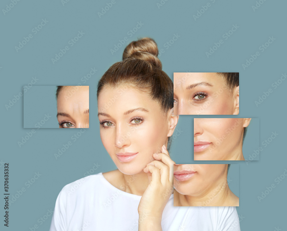 Effects of ageing,Frown/scowl lines ,Nasolabial folds,Neck ,Under eye ...