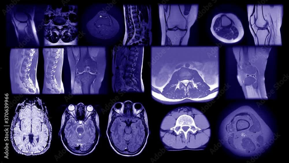 MRI scans set multi screen, human brain, head, body, bones, spine and ...