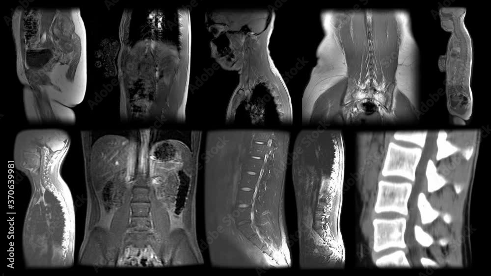 MRI scan timelapse of various sides human body, spine, bones organs, magnetic resonance imaging ...
