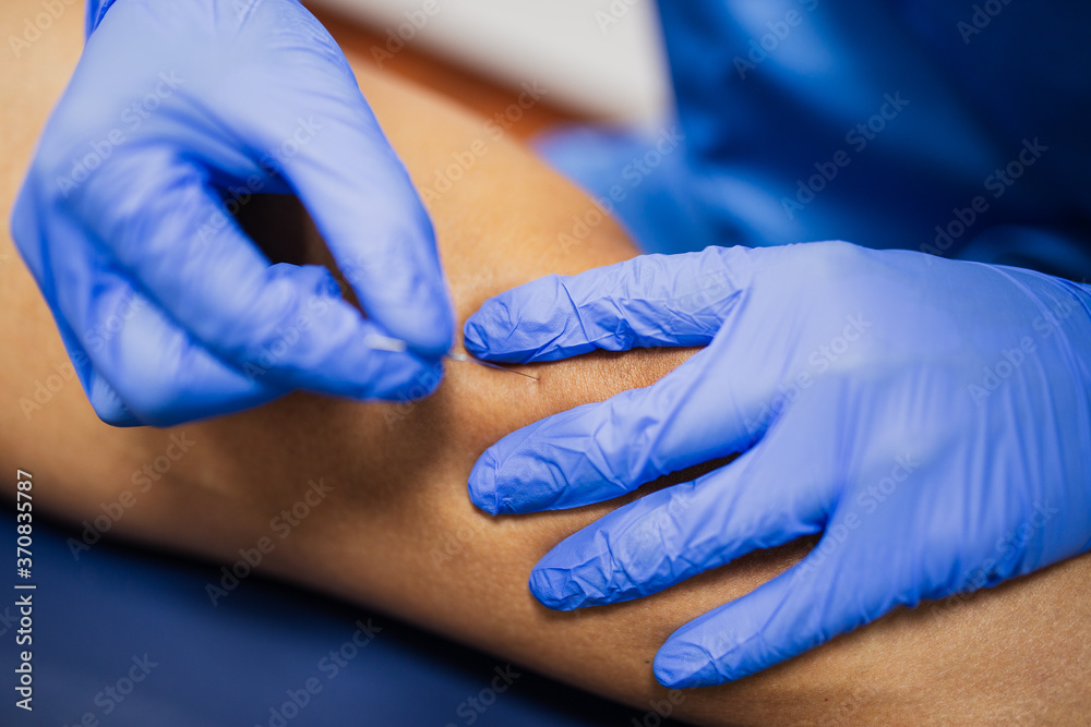 Fotografia do Stock: From above of crop faceless sports medicine doctor ...