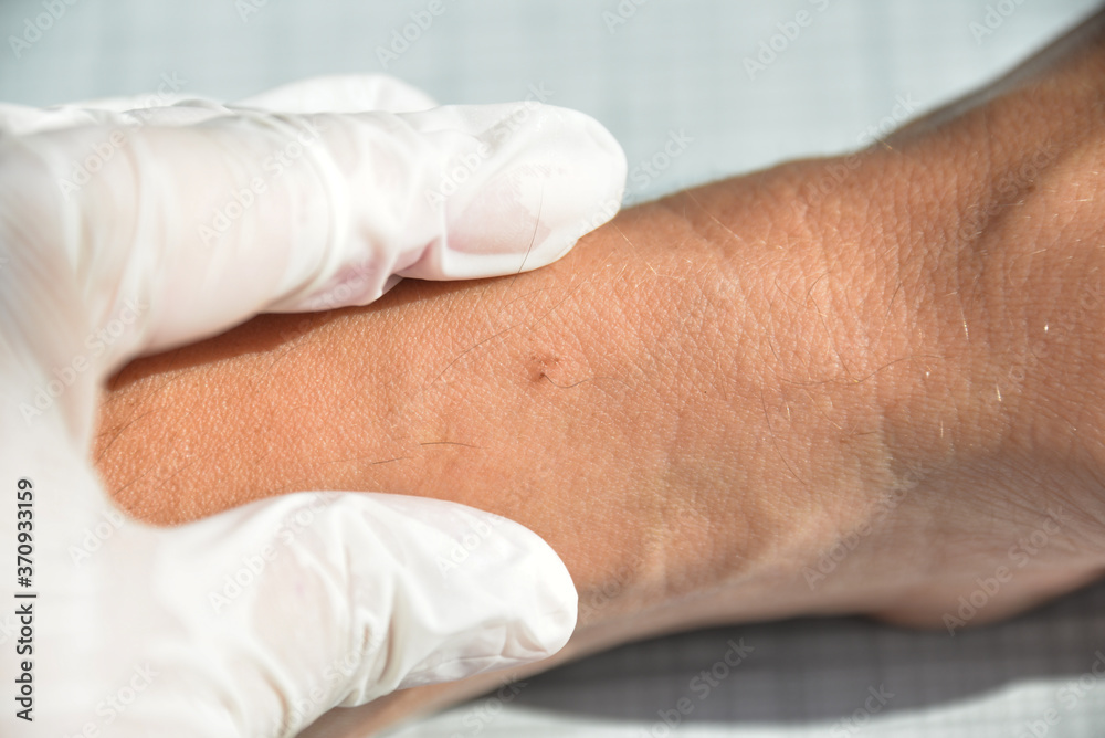Skin diseases irritation, itching, cracked wounds lead to painful ...