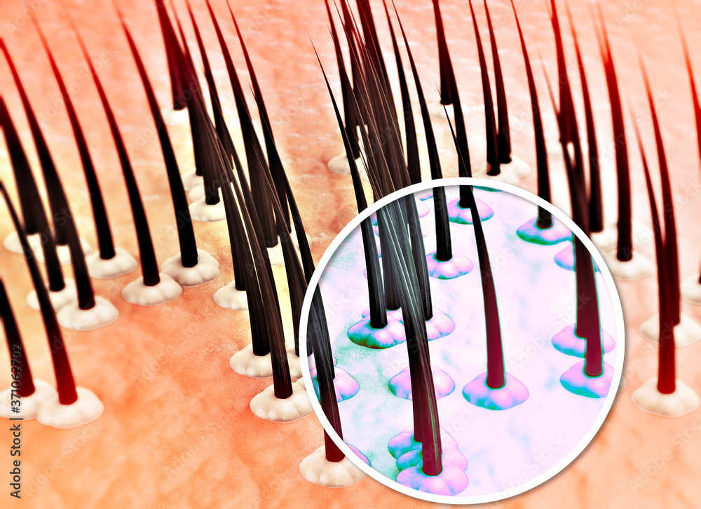 Surface of the skin, hair, hair health, trichology, fat, dandruff of ...