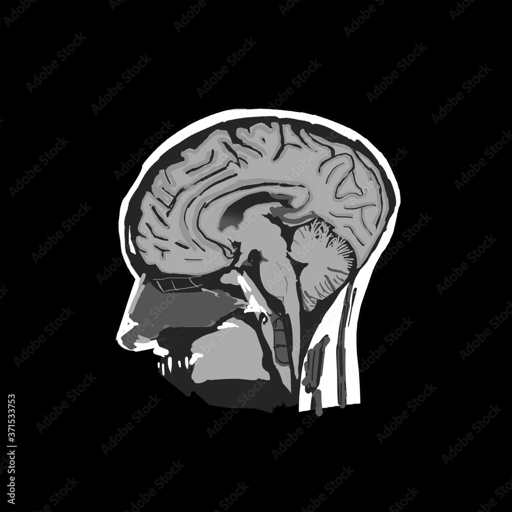 Brain head skull MRI magnetic resonance image illustration sagittal ...