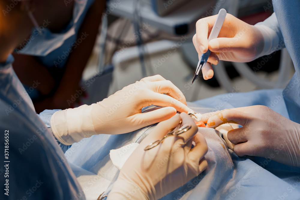 Blepharoplasty plastic surgery operation for modifying the eye region ...