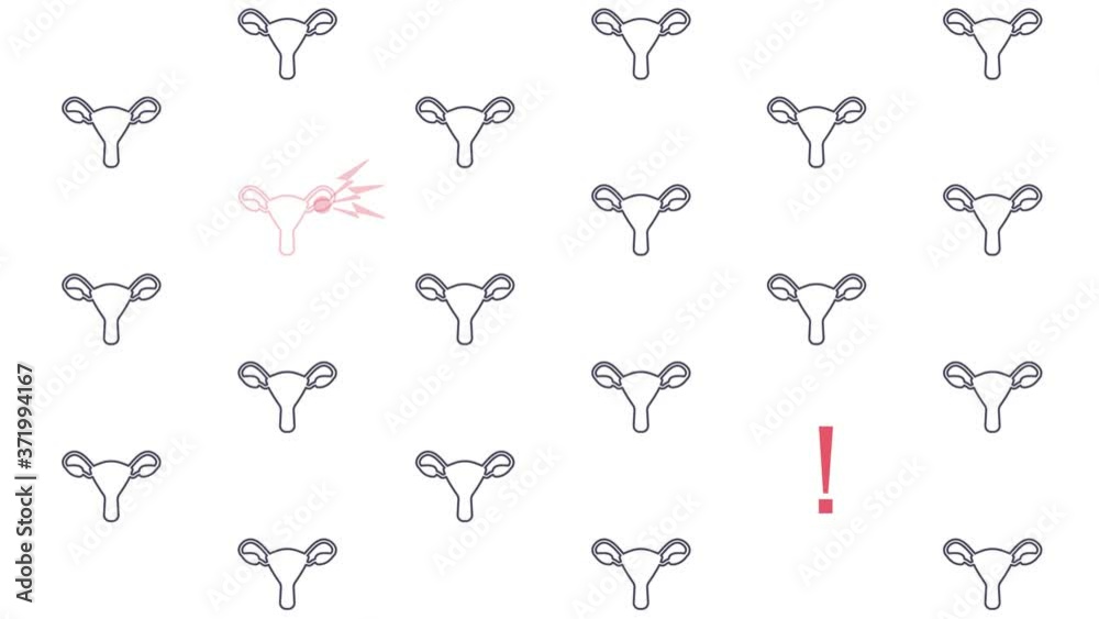 Uterus pattern cartoon animation for ovarian cancer awareness. Women ...