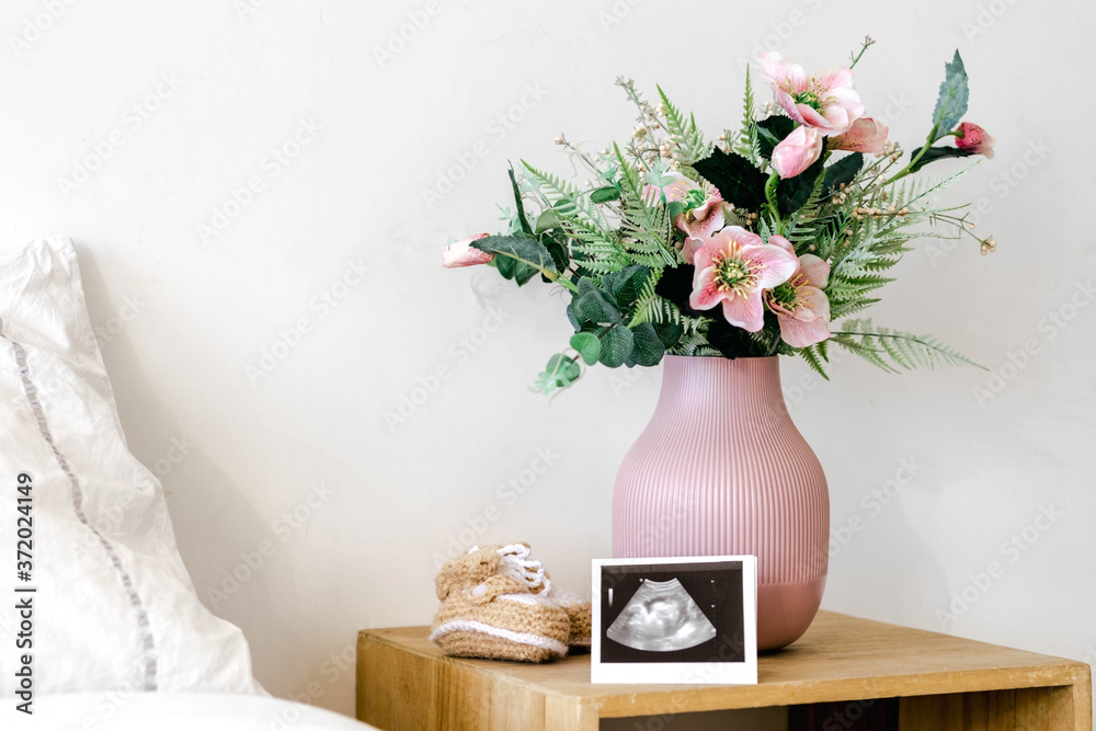 Ultrasound image of an unborn baby 24 weeks old. The family is waiting ...