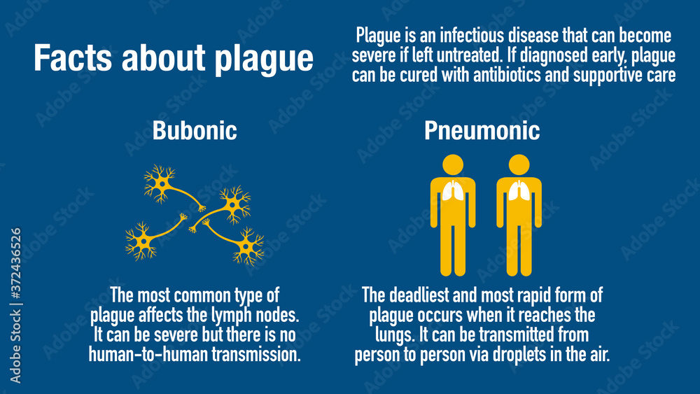 Poster Infographic with facts about plague – Wall Art | UkPosters