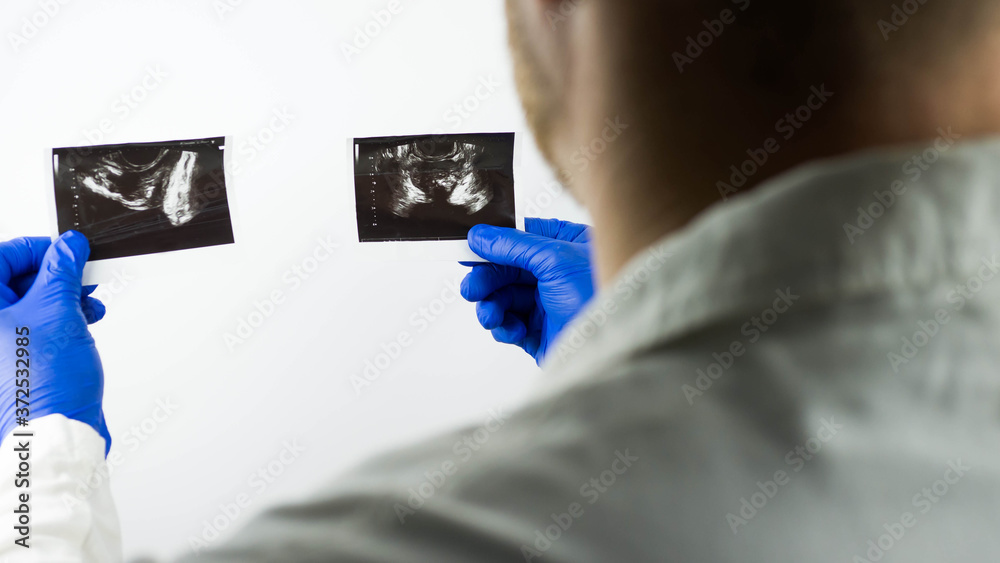 Ultrasound of the prostate gland in the hands of a doctor,to make a ...