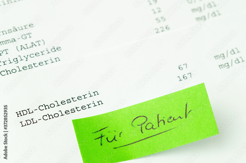 german Laboratory blood count for HDL and LDL cholesterol. word - Für ...