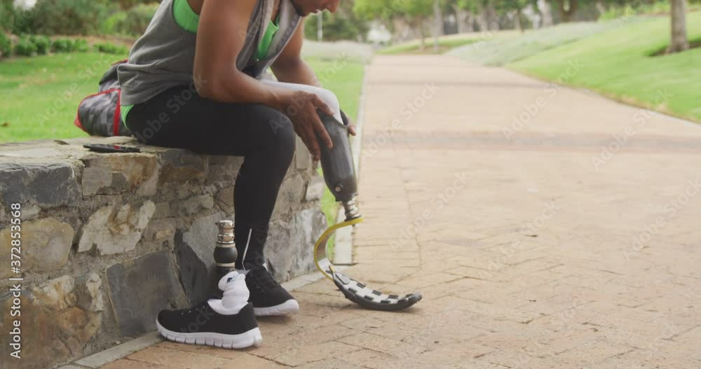 Side view man putting on his prosthetic leg Stock Video | Adobe Stock