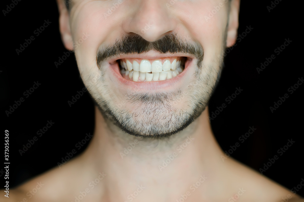 Man's dental problems, close-up. Uneven, aching teeth, malocclusion ...