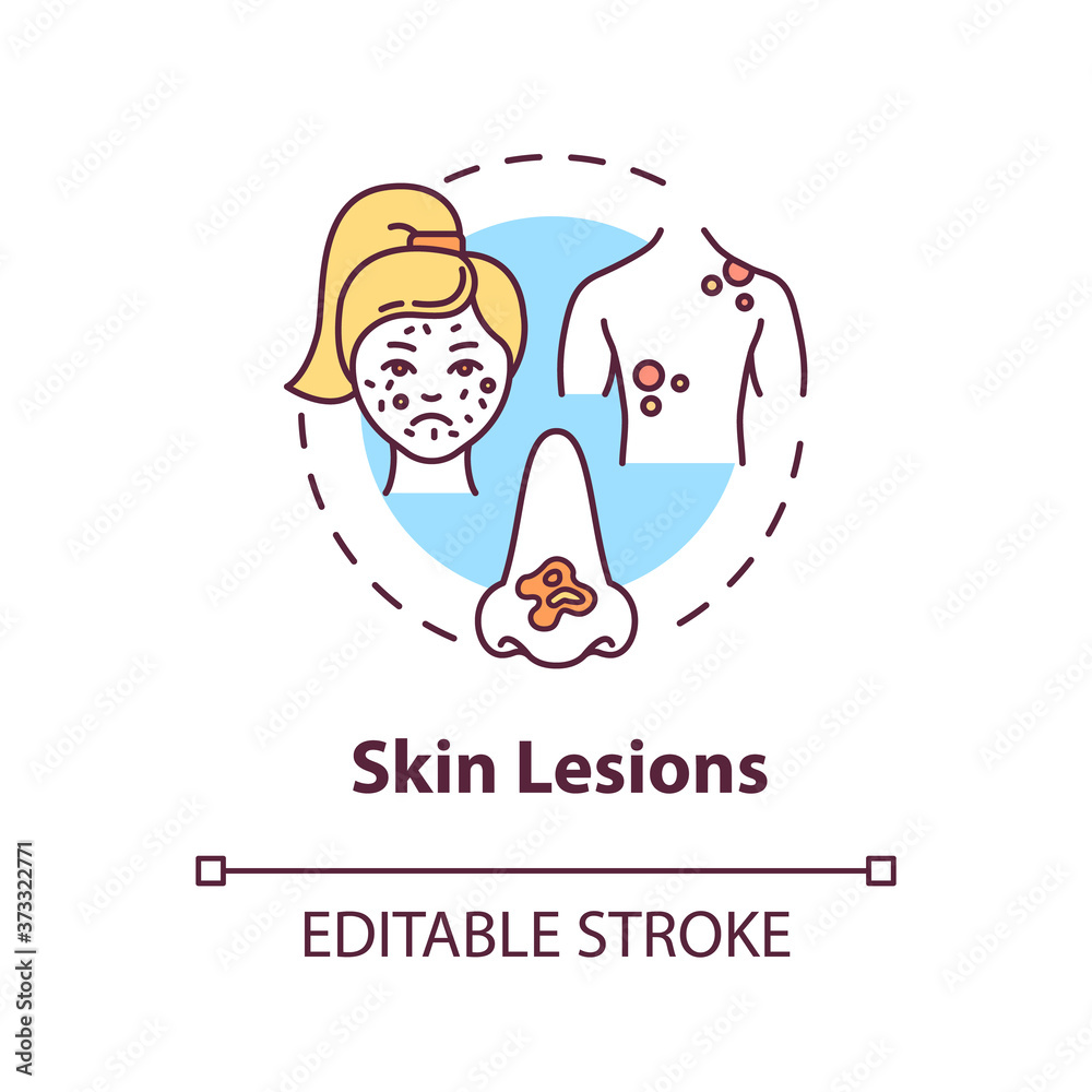 Skin lesions concept icon. Dermatology. Skin patches and wounds ...