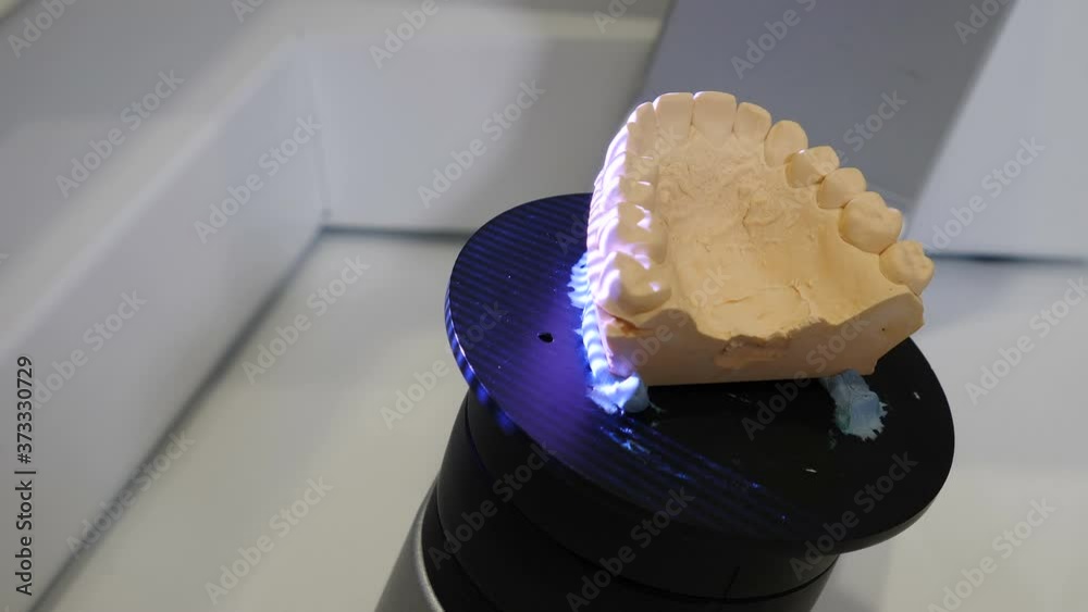 3d tooth scanning in modern dentistry. Dental prosthetic restoration ...