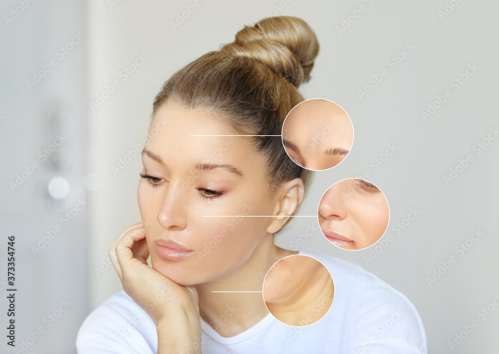 Effects of ageing,Frown/scowl lines ,Nasolabial folds,Neck ,Under eye ...