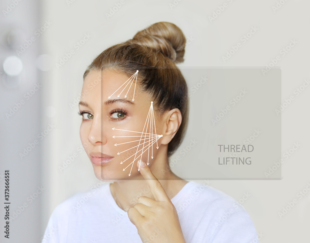 thread lift procedure ,non-surgical facelift,markup Stock Photo | Adobe ...