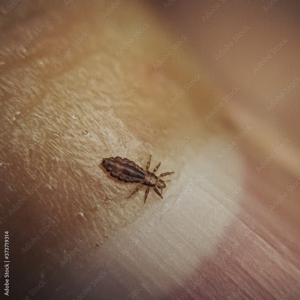 A Head Louse! Adult lice are small flattened & entirely wingless ...